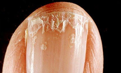 Diseases and Conditions - Healthool