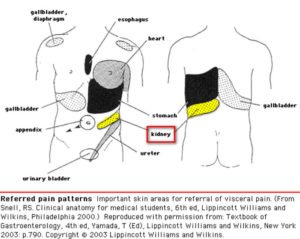 👉 Kidney Pain - (Location, anatomy), lower back, Vs Back pain, Causes ...