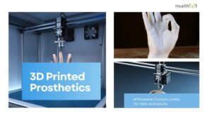 3D Printed Prosthetics: Affordable Custom Limbs for Kids and Adults