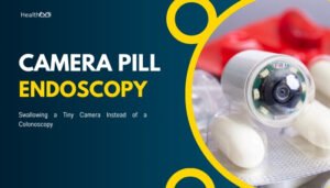 Camera Pill Endoscopy: Swallowing a Tiny Camera Instead of a Colonoscopy
